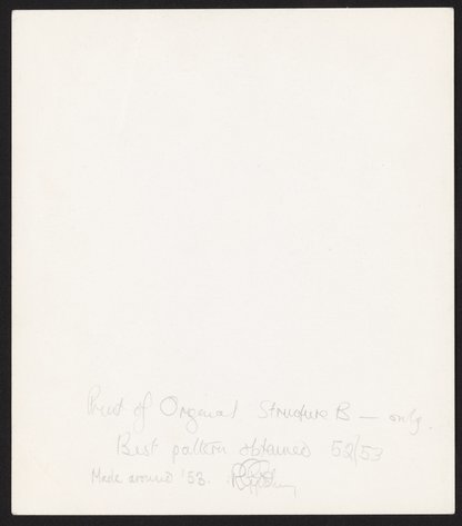 DNA X-ray diffraction image known as Photo 51, Annotated by Raymond ...