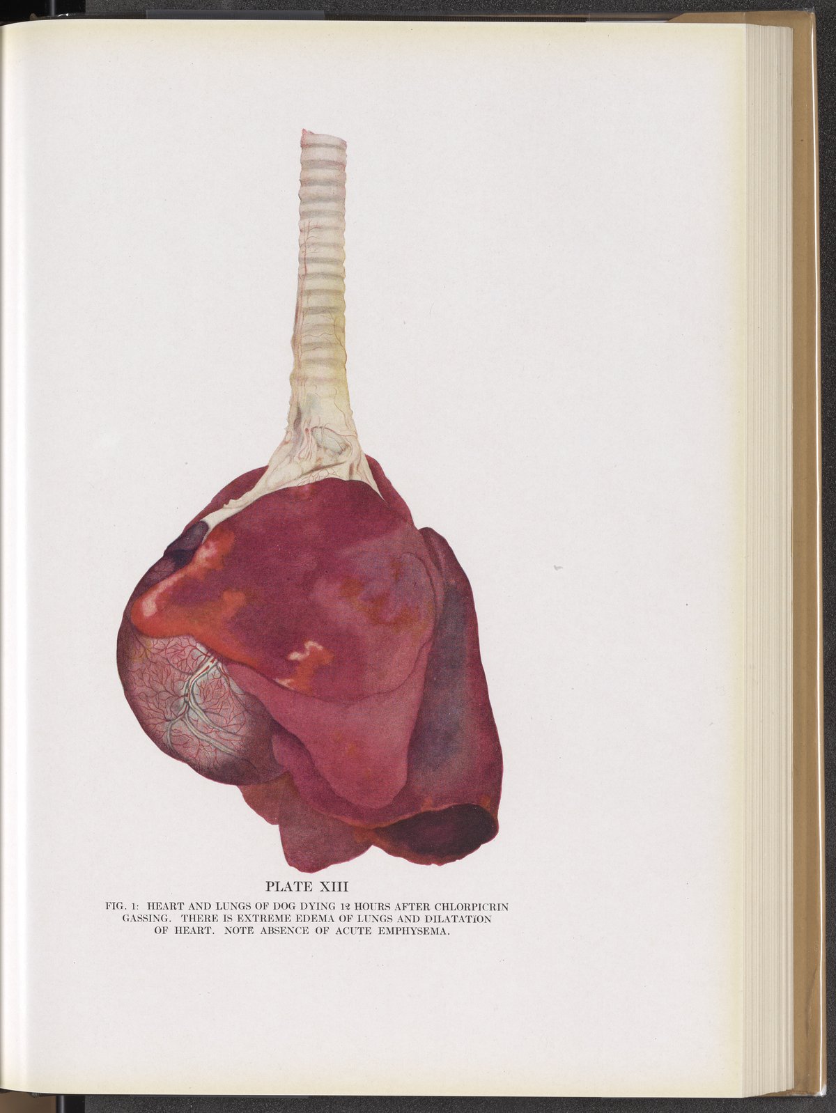 Plate XIII (Fig. 1): Heart and lungs of dog dying 12 hours after ...