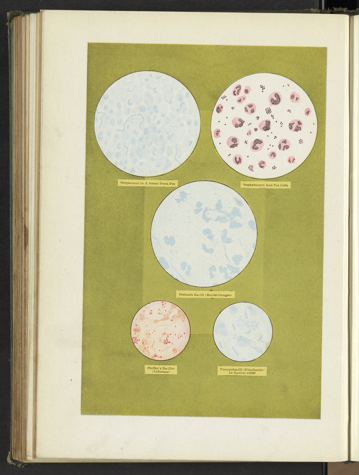 Streptococci, pertussis, Pfeiffer's Bacillus, and pneumobacilli ...