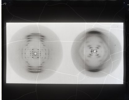 DNA X-ray diffraction image known as Photo 51, Annotated by Raymond ...