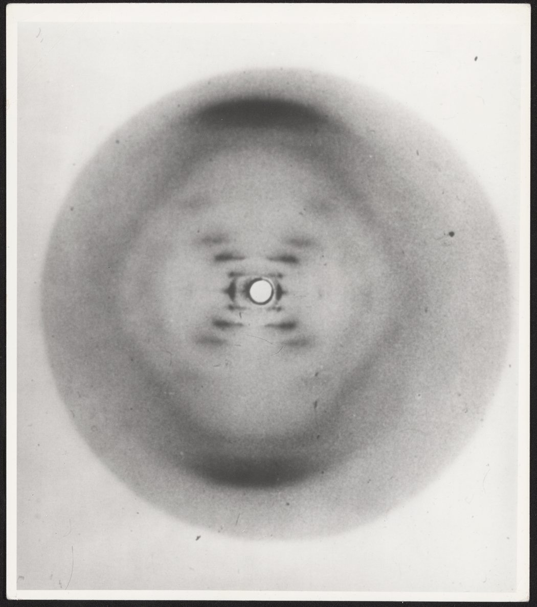 DNA X-ray diffraction image known as Photo 51, Annotated by Raymond ...