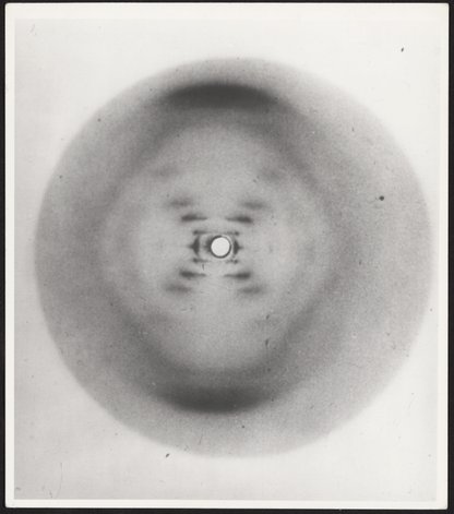 DNA X-ray diffraction image known as Photo 51, Annotated by Rosalind ...
